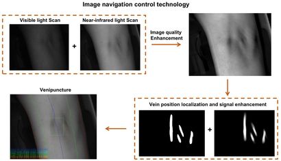 venipuncture articles