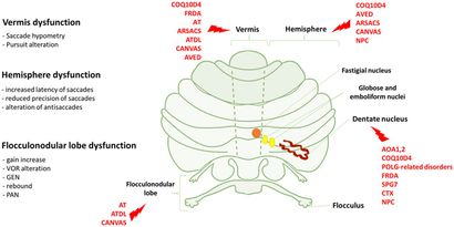 cerebellar dysfunction often causes