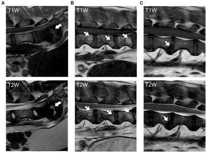 degenerative marrow changes