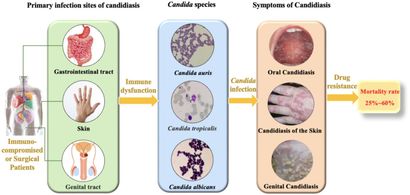 candidiasis cell structure