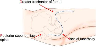 sacral tuberosity function