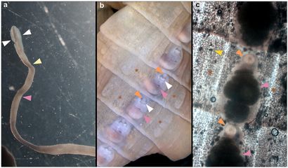 spirometra mansonoides cdc