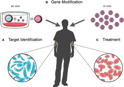 somatic gene therapy