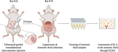 amniotic fluid sample collection