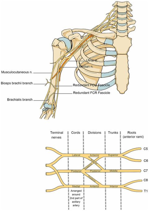 brachial plexus disorders