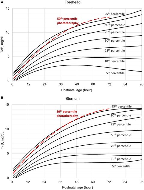 phototherapy nomogram