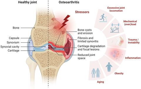 active synovitis treatment