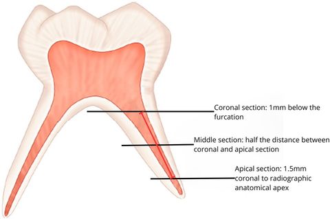 primary dentine features