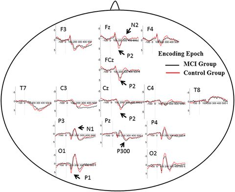 retrieval memory deficit