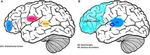 orbitofrontal cortex in ocd