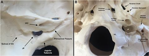 foramen lacerum function