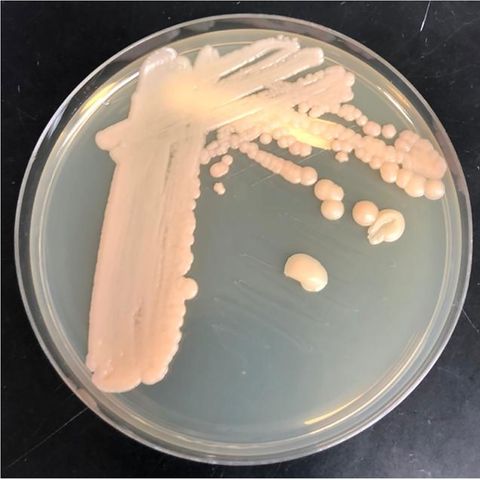 cryptococcus neoformans colony