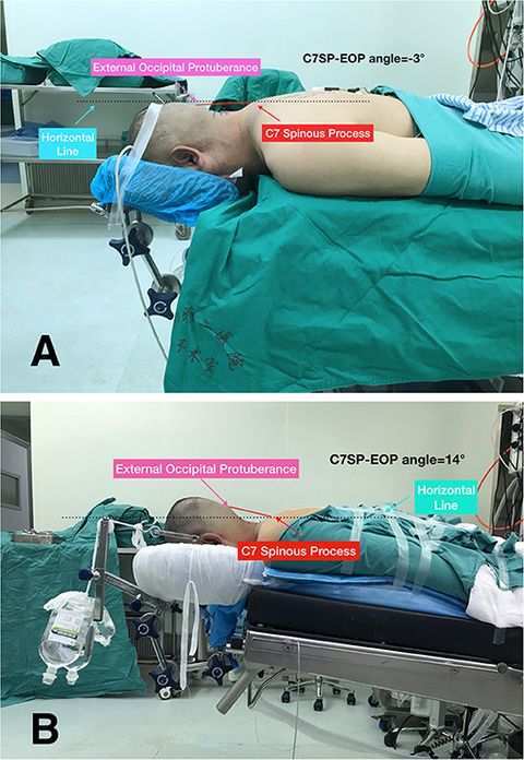 surgery prone position