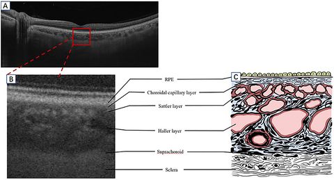 choroid 3 layers