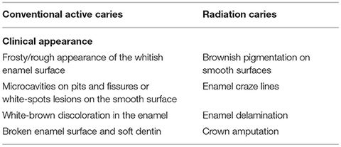 radiation caries
