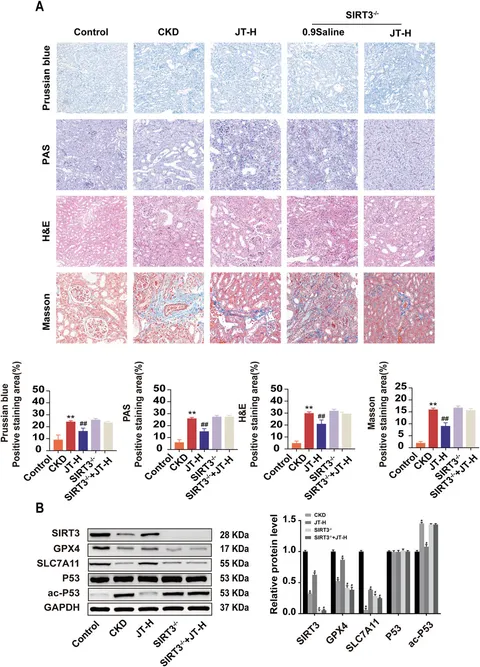 Frontiers | Jingtian granule alleviates adenine-induced Frontiers | Jingtian granule alleviates adenine-induced
